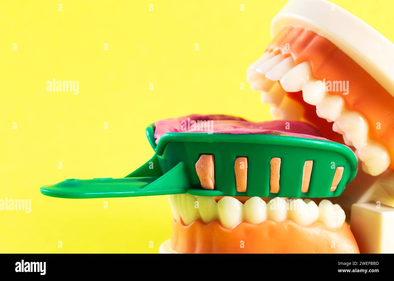 Green dental spoon for taking a dental impression in a mock-up of a ...