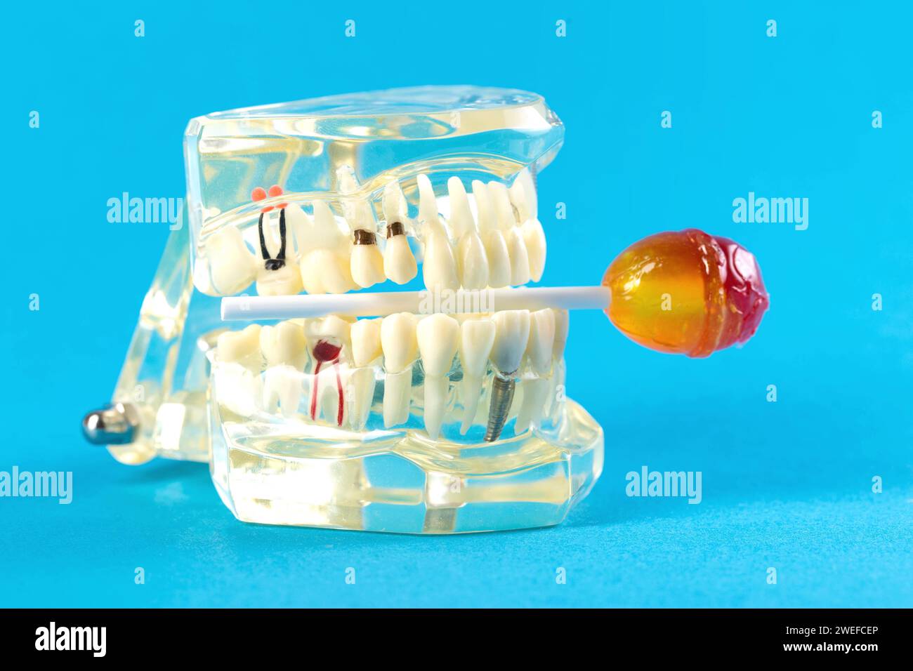 Candy on a stick in a tooth jaw mockup on a blue background. Concept of ...