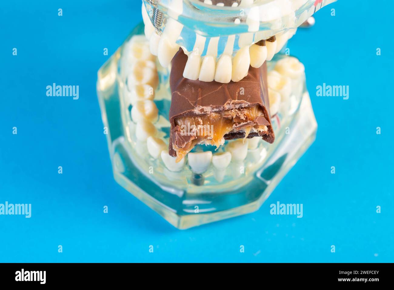 A bitten piece of chocolate in a dental jaw mockup on a blue background ...