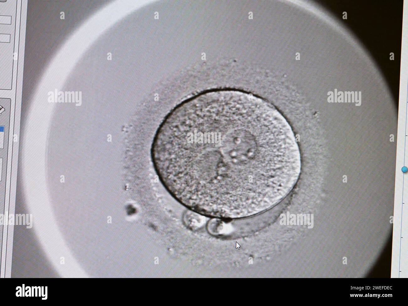 Ivf egg screen hi-res stock photography and images - Alamy