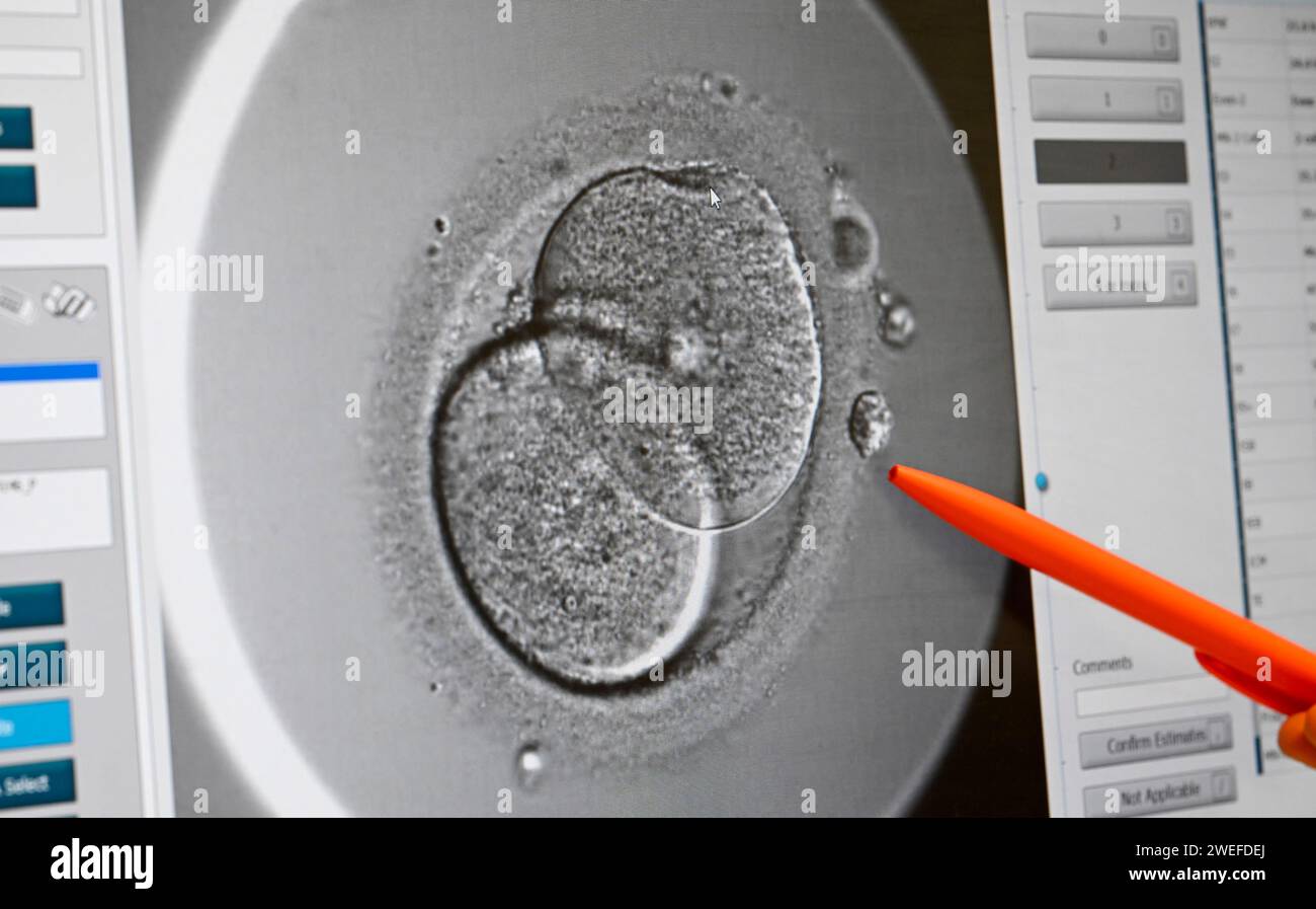 Fertilized egg hi-res stock photography and images - Alamy