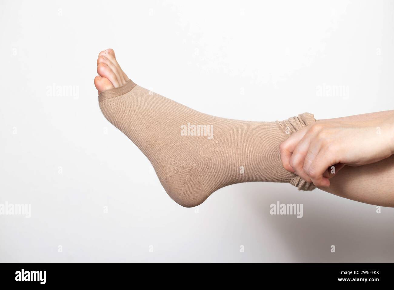 A woman puts on compression stockings for legs with varicose veins ...