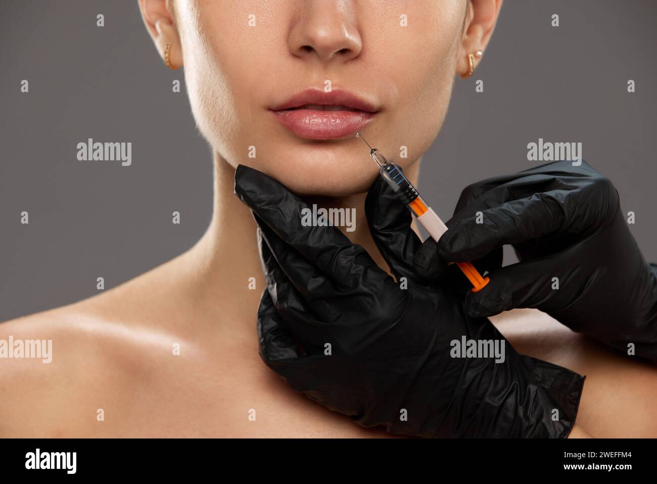 Lip augmentation. Cropped image of female face, woman doing lip ...