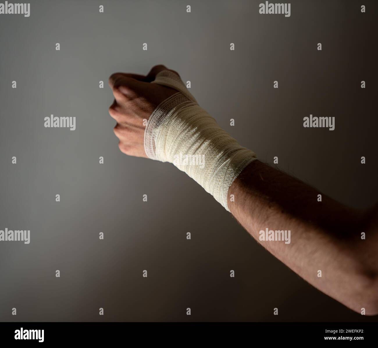 Left hand injury hi-res stock photography and images - Alamy