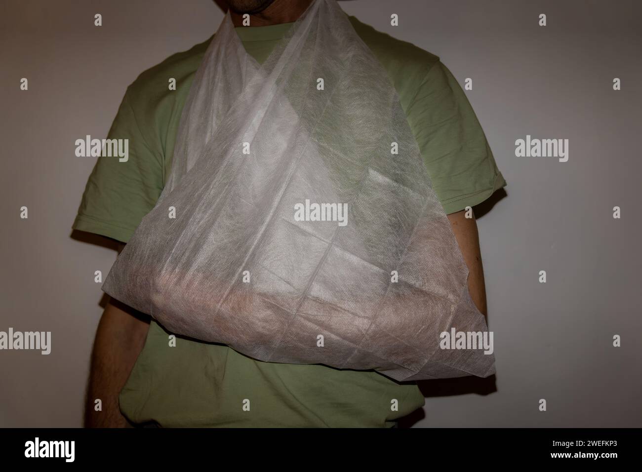 Male left hand injury with triangle bandage Stock Photo - Alamy