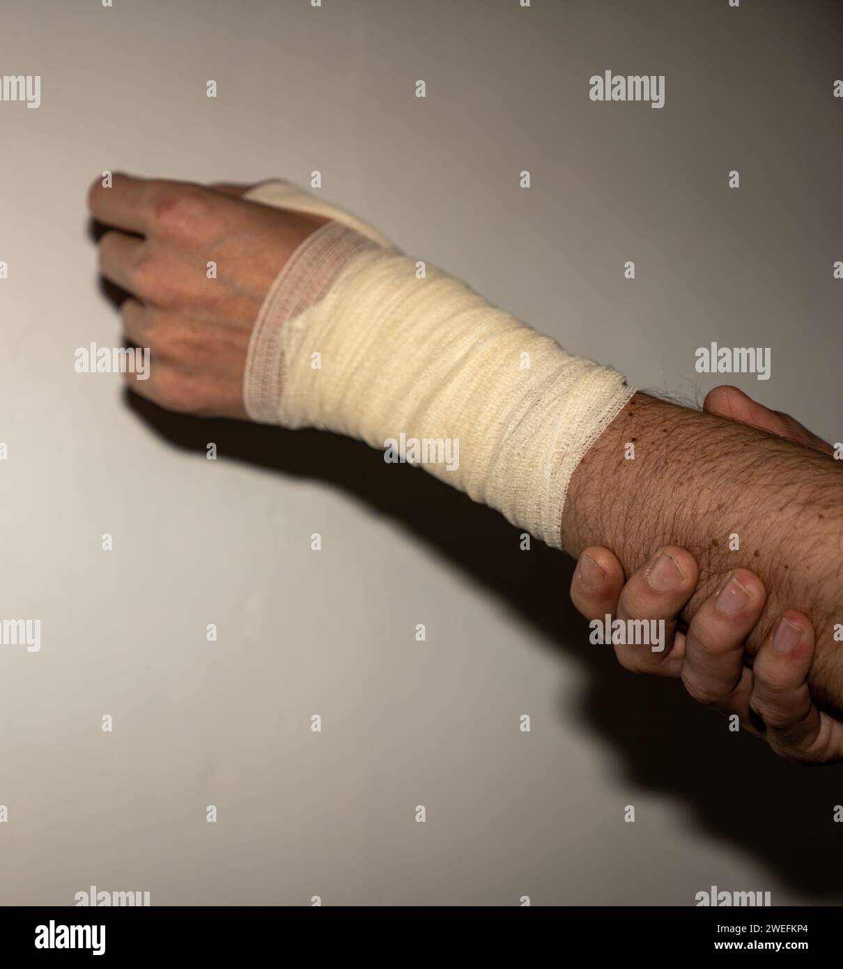 Male left hand injury with bandage Stock Photo - Alamy