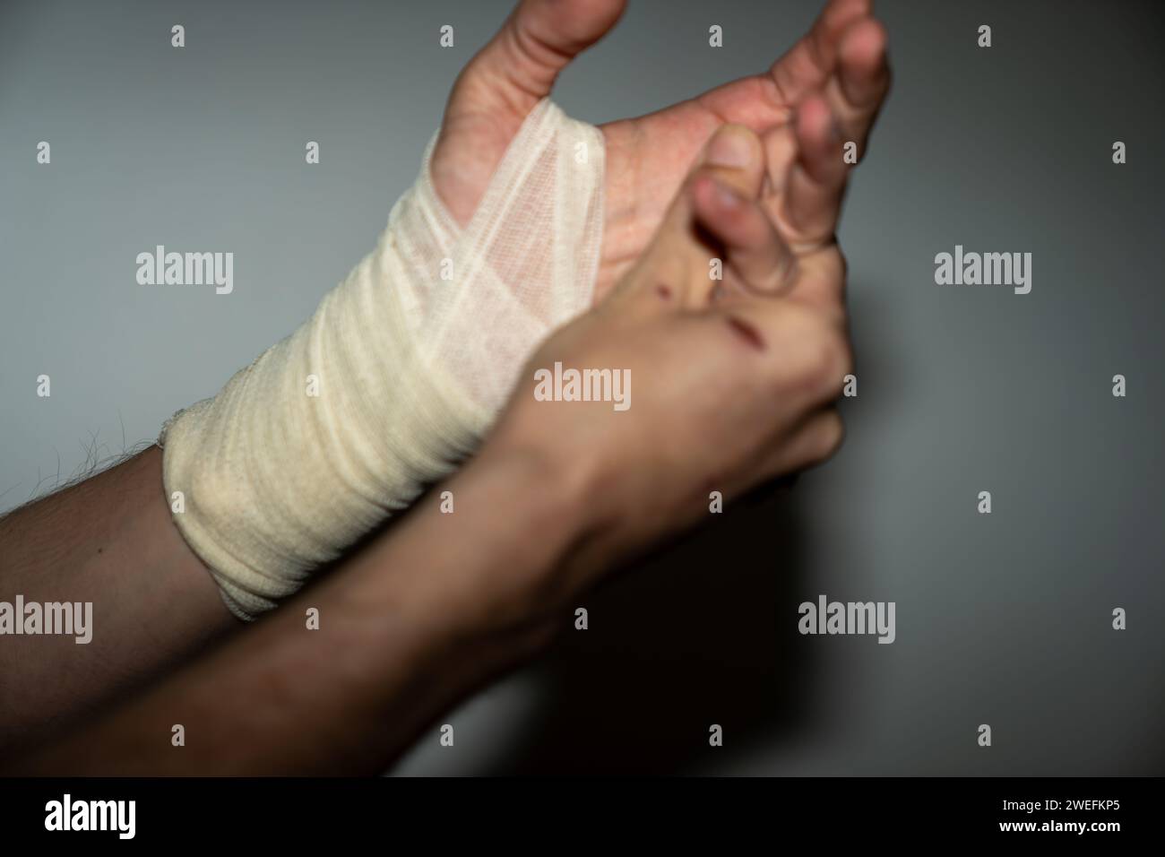 Male left hand injury with bandage Stock Photo - Alamy