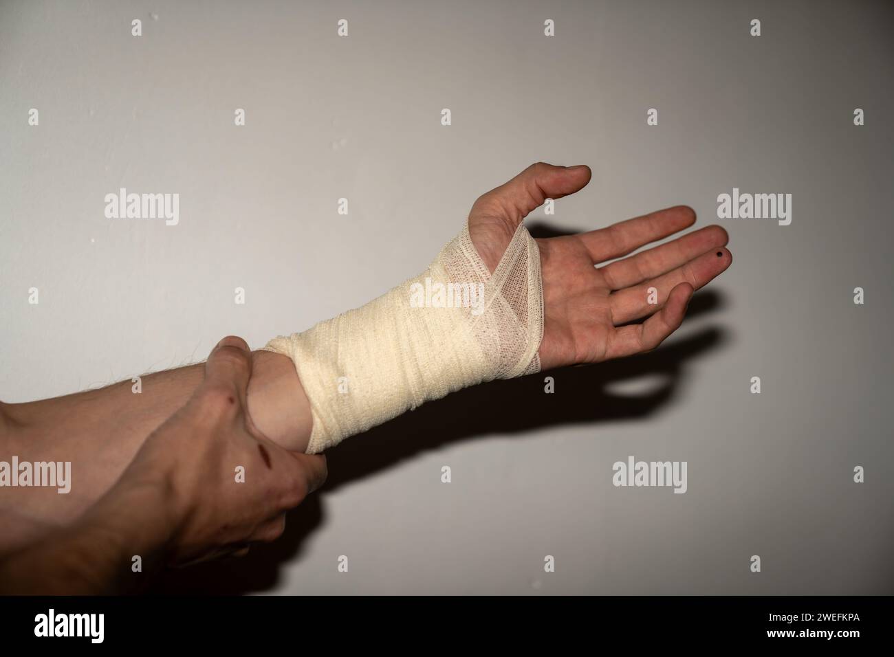 Left hand injury hi-res stock photography and images - Alamy