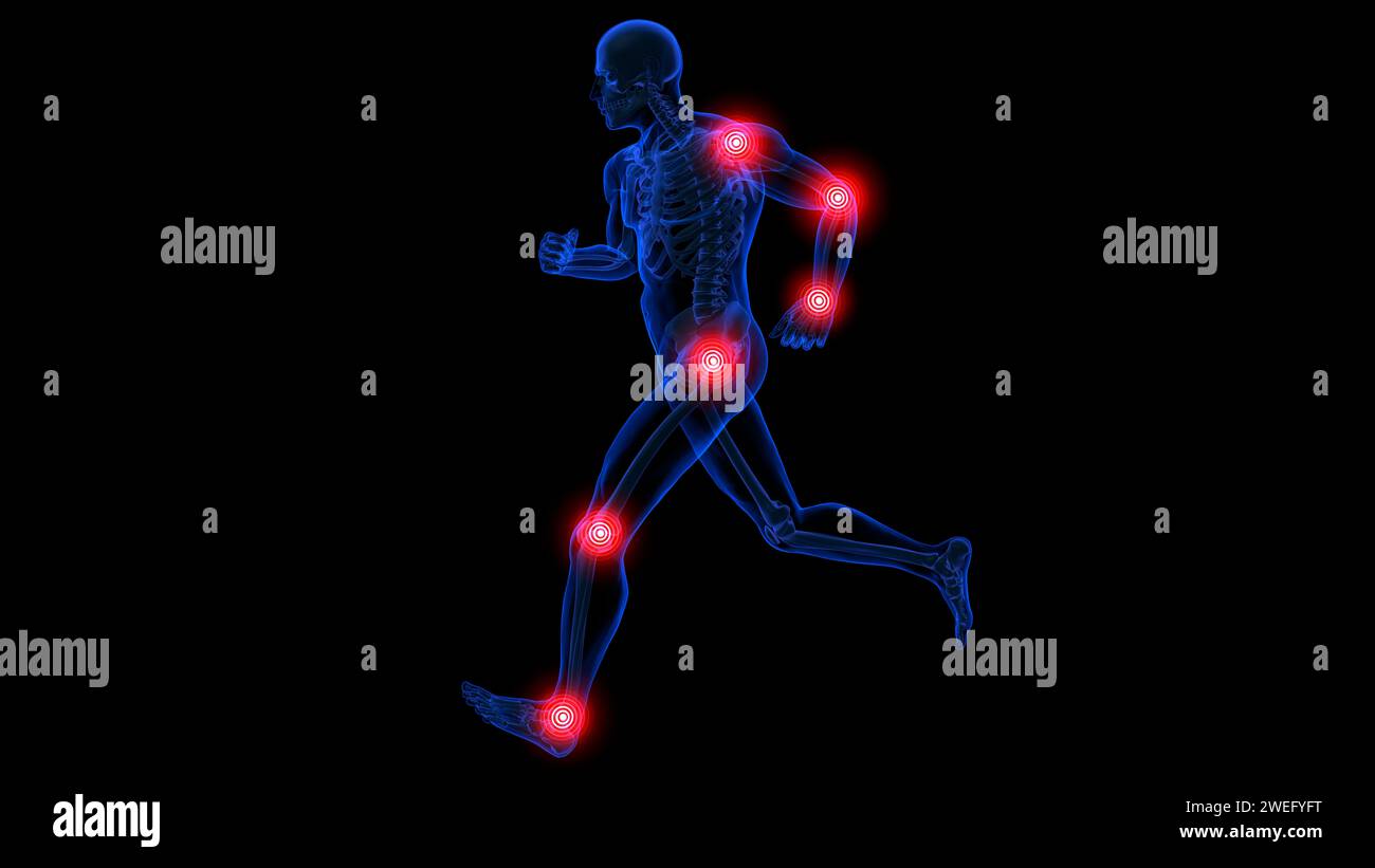 Human skeleton joint pain anatomy for medical concept 3D illustration ...