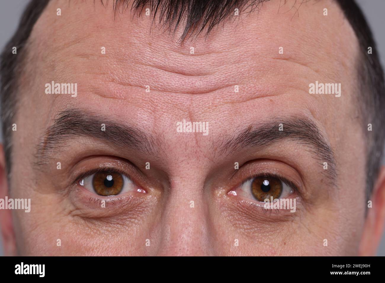 Wrinkles on the forehead hi-res stock photography and images - Alamy