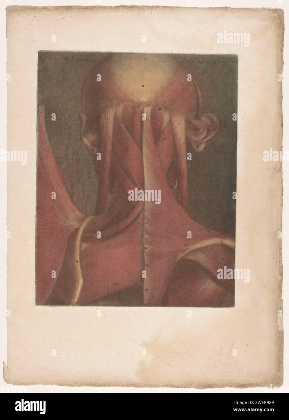 Men's head whose muscles of the back and the neck can be seen, Jacques ...