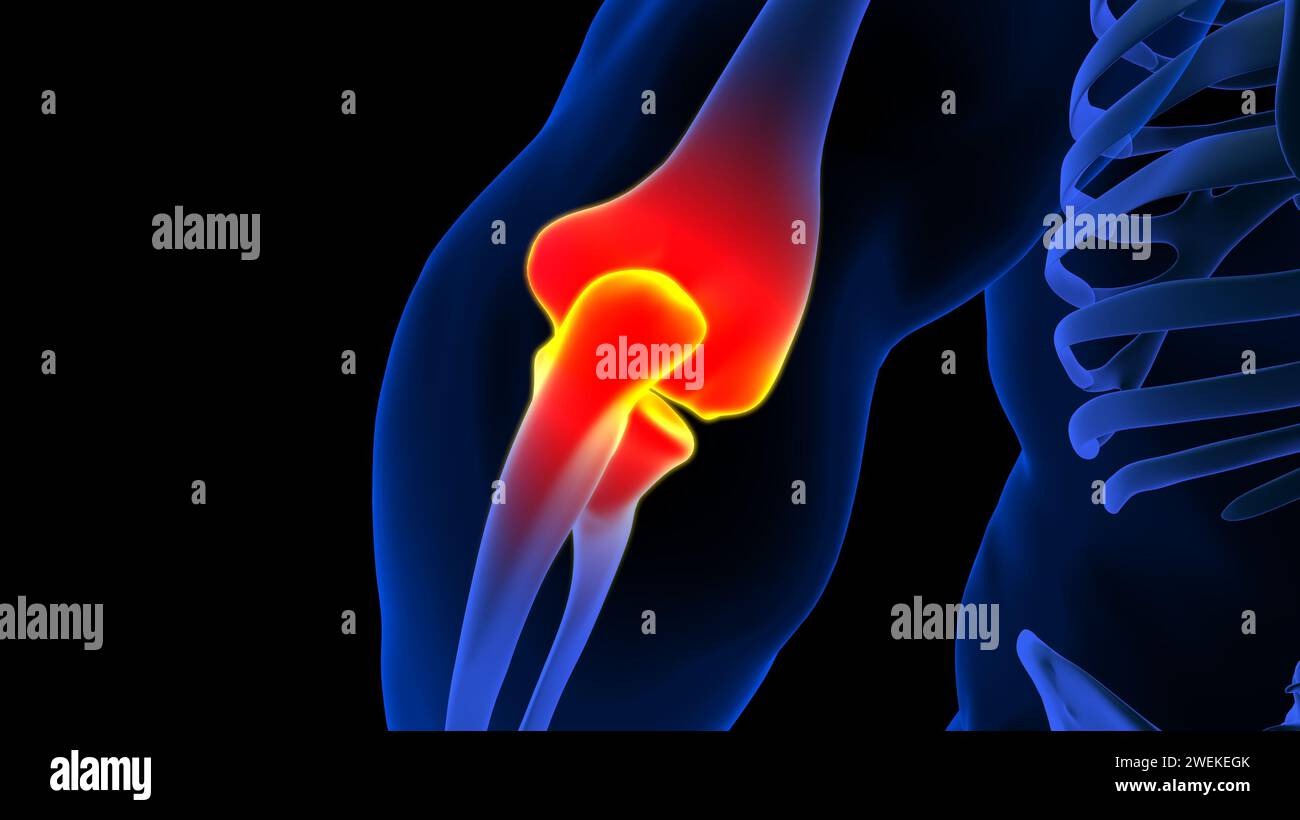 Elbow joint pain anatomy for medical concept 3D illustration Stock ...