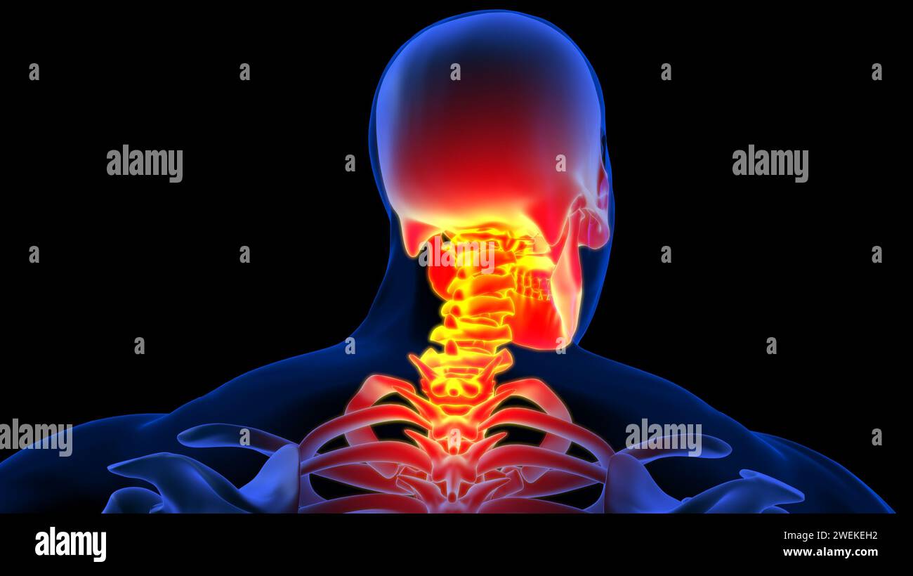 Human skeleton neck or cervical pain anatomy for medical concept 3D ...