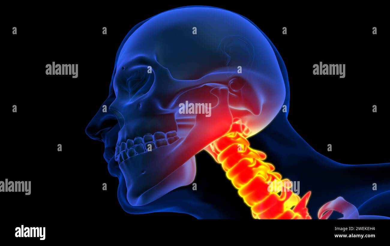 Human skeleton neck or cervical pain anatomy for medical concept 3D ...