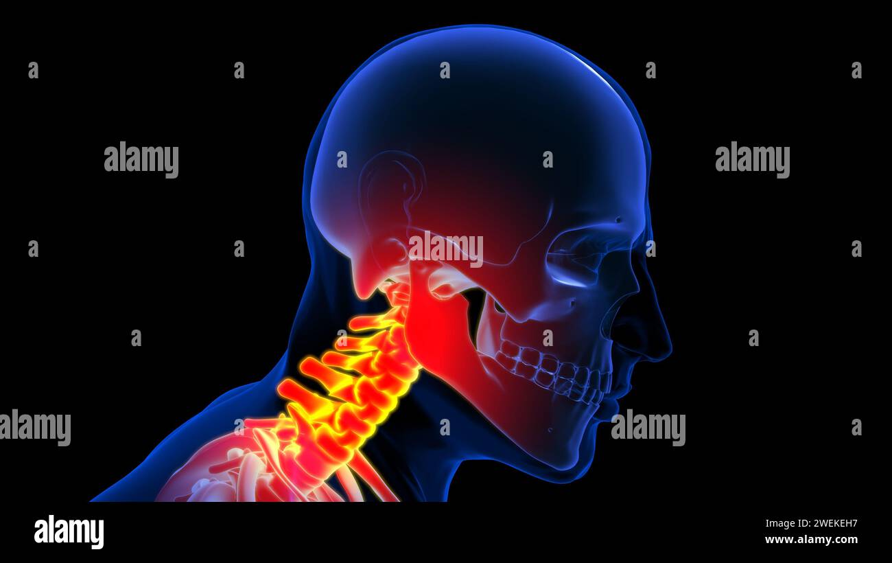 Human skeleton neck or cervical pain anatomy for medical concept 3D ...