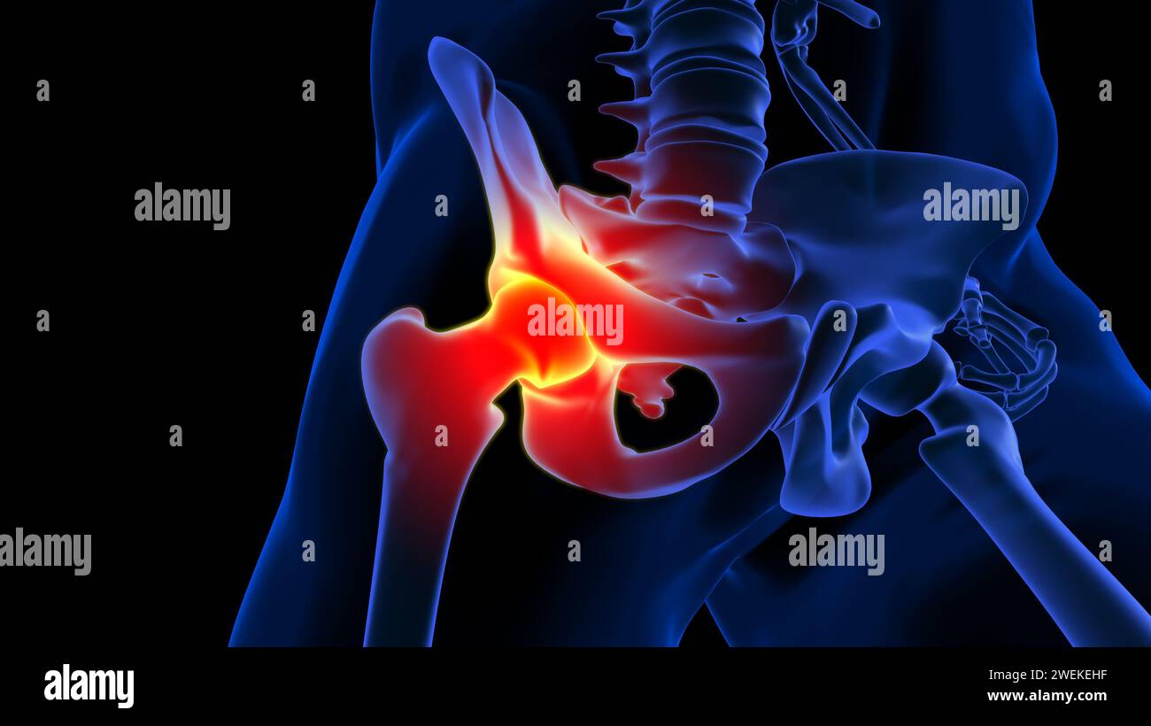 Hip joint pain anatomy for medical concept 3D illustration Stock Photo ...