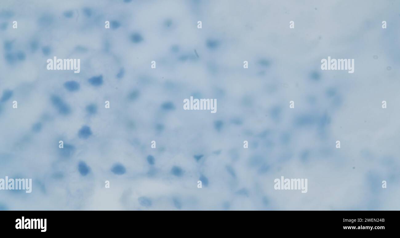 virus structure under a microscope Stock Photo - Alamy