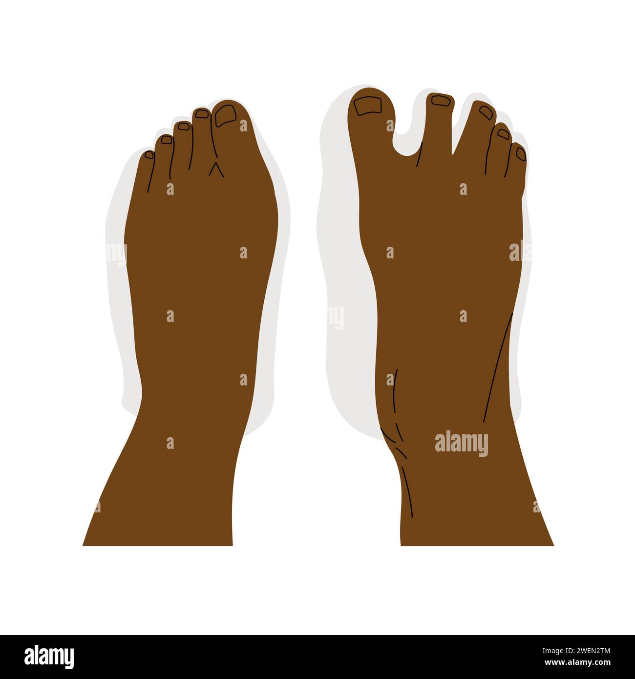 Barefoot Shoes Before And After at Sara Gosman blog