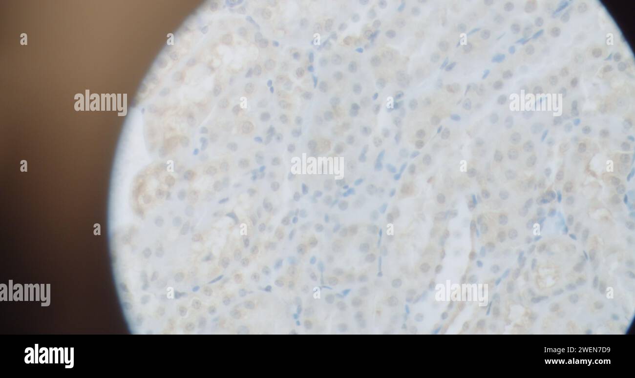 virus structure under a microscope Stock Photo - Alamy