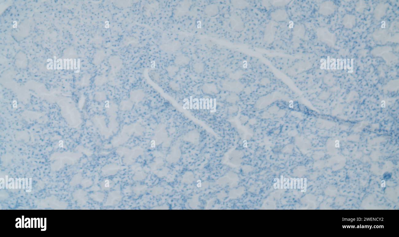 virus structure under a microscope Stock Photo - Alamy