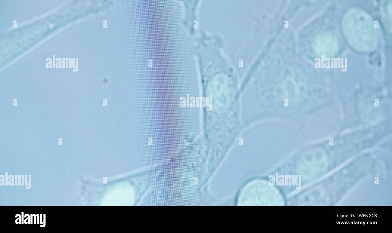 close up of bacteries moving under microscope Stock Photo - Alamy
