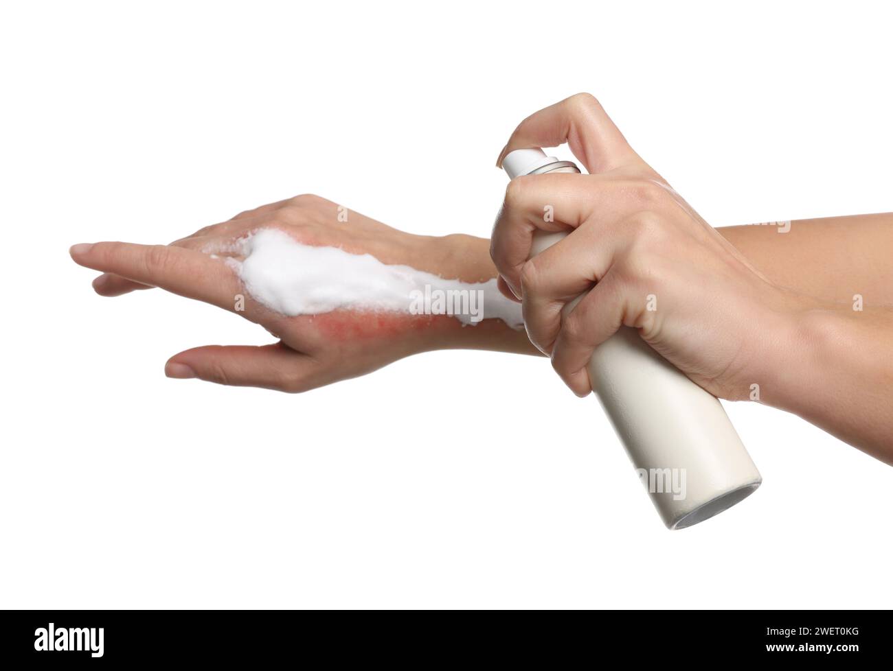 Woman applying panthenol onto burned hand on white background, closeup ...