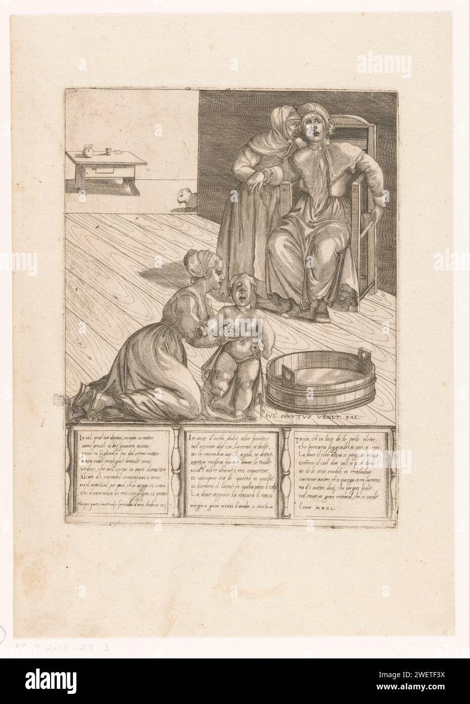 Birth deformed hi-res stock photography and images - Alamy