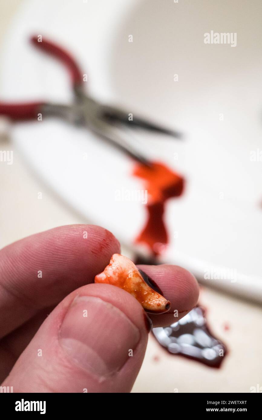 Seattle, USA. 22 Jan, 2024. Self tooth extraction concept Stock Photo ...