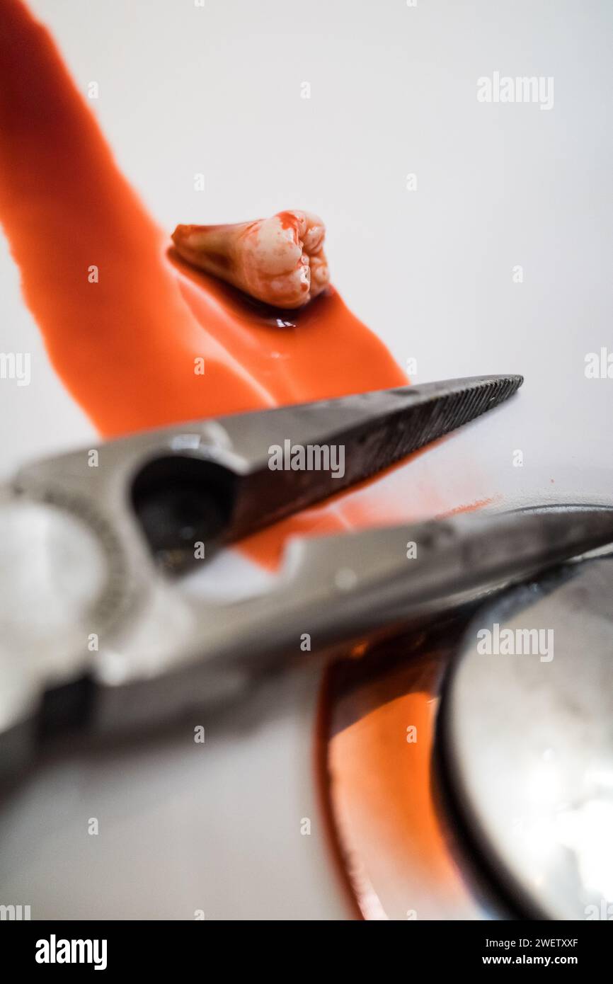 Seattle, USA. 22 Jan, 2024. Self tooth extraction concept Stock Photo ...