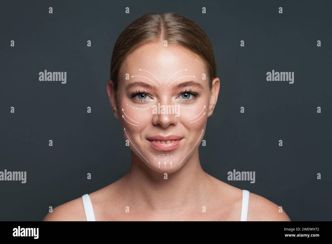 Cheerful woman. Face lift anti-aging lines on young female face ...