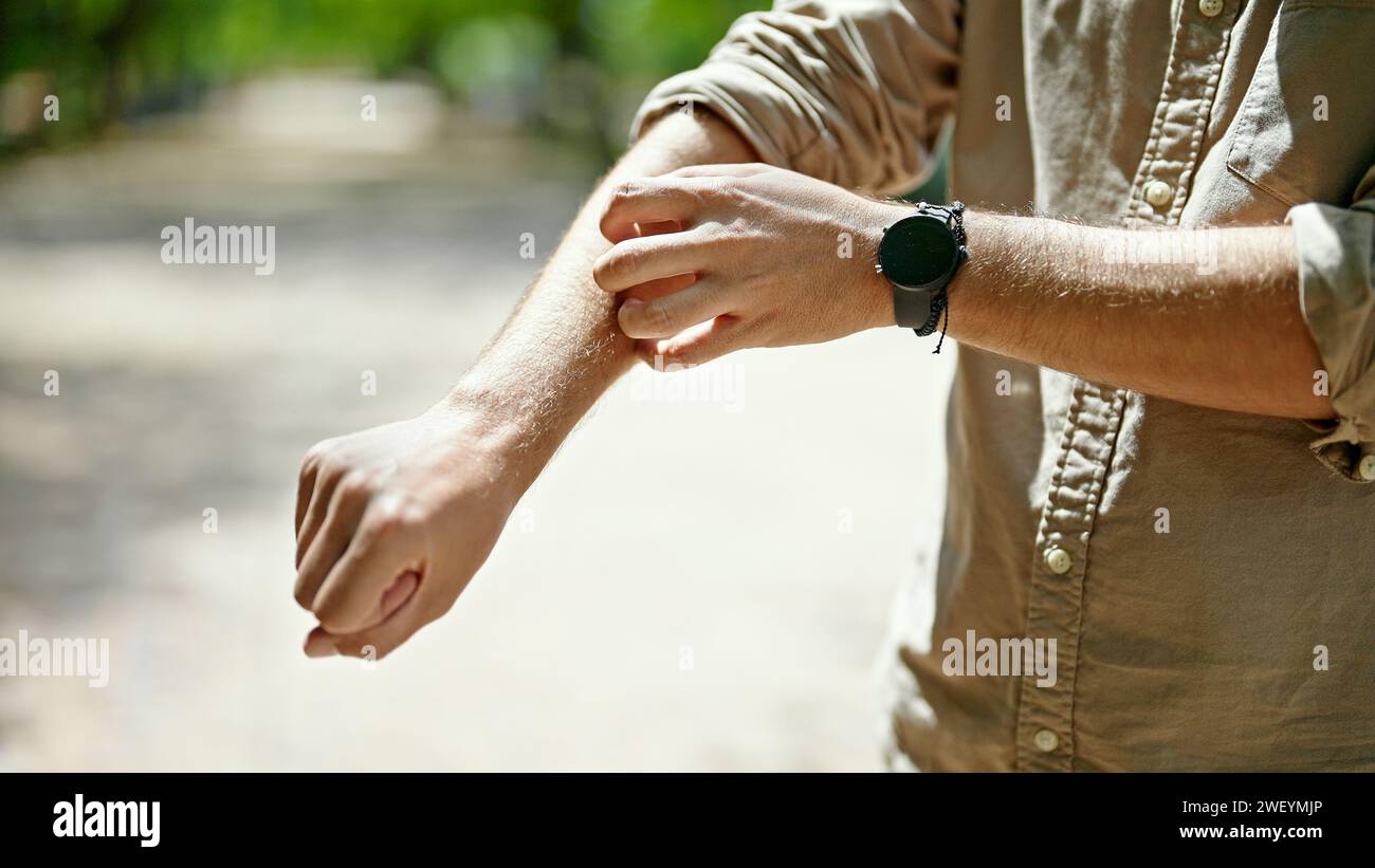 Adult hispanic man allergic irritation hi-res stock photography and ...