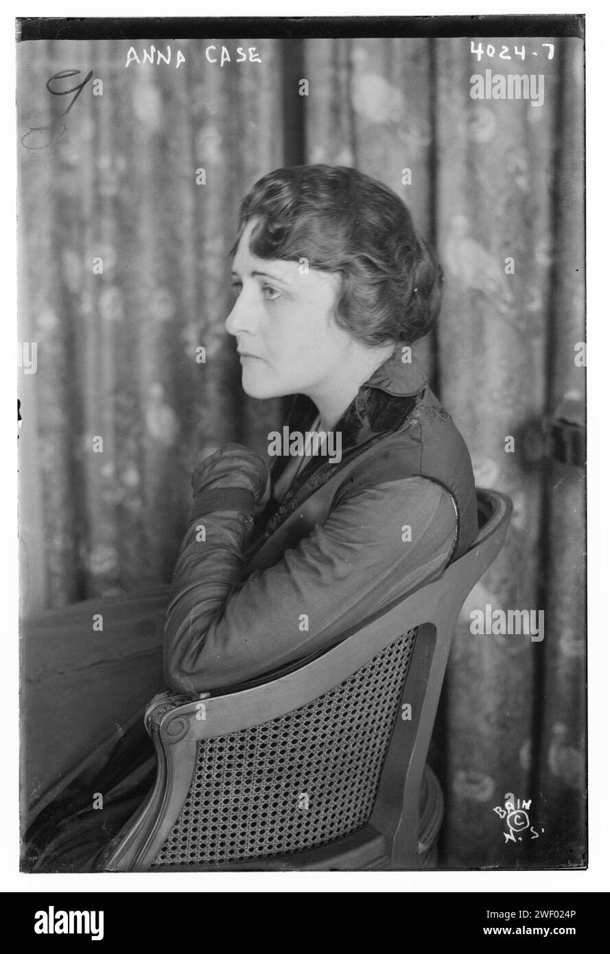 Anna Case in 1917 Stock Photo - Alamy