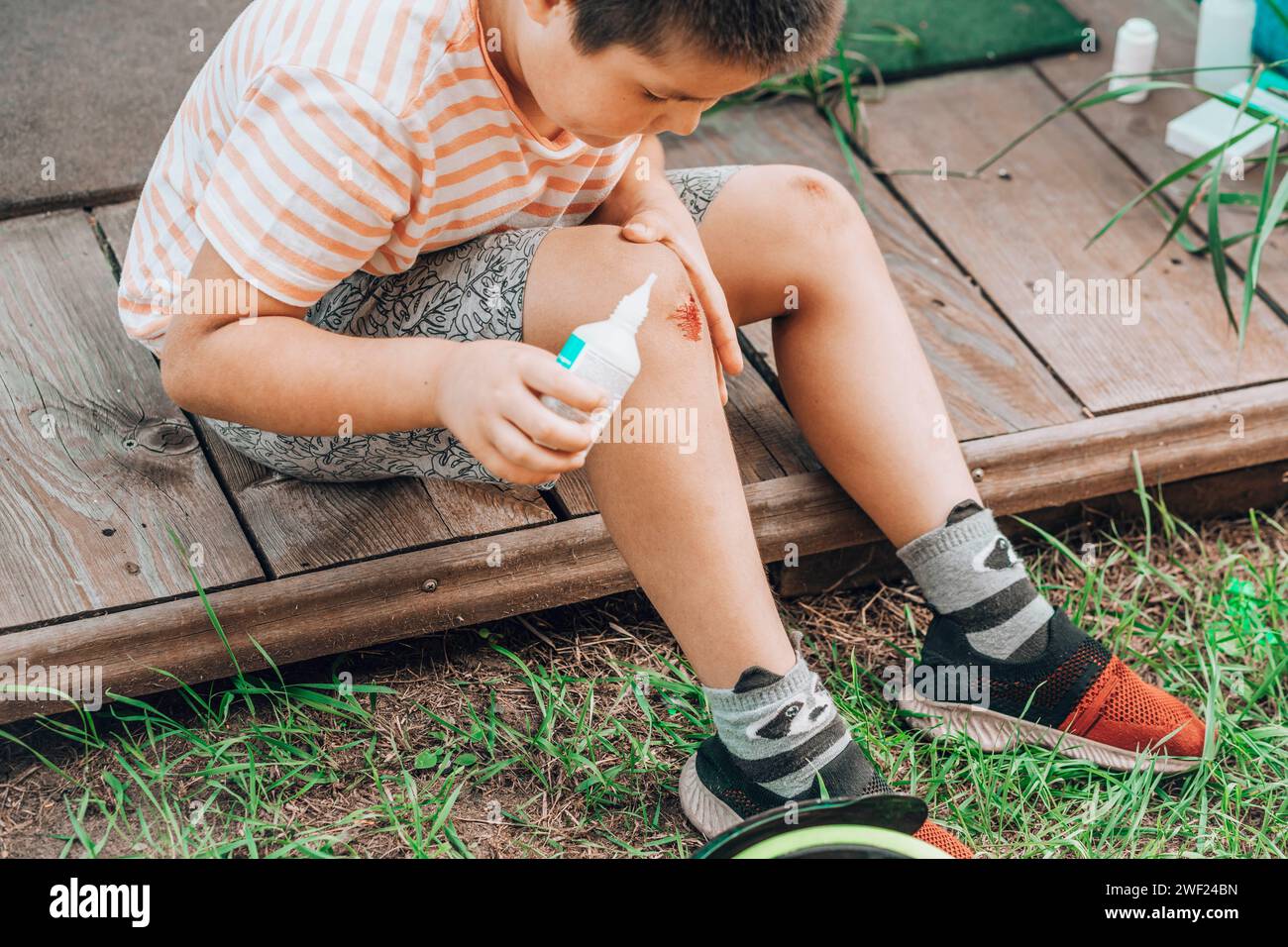 child's leg injury. The child injured his knee when he fell off. boy ...