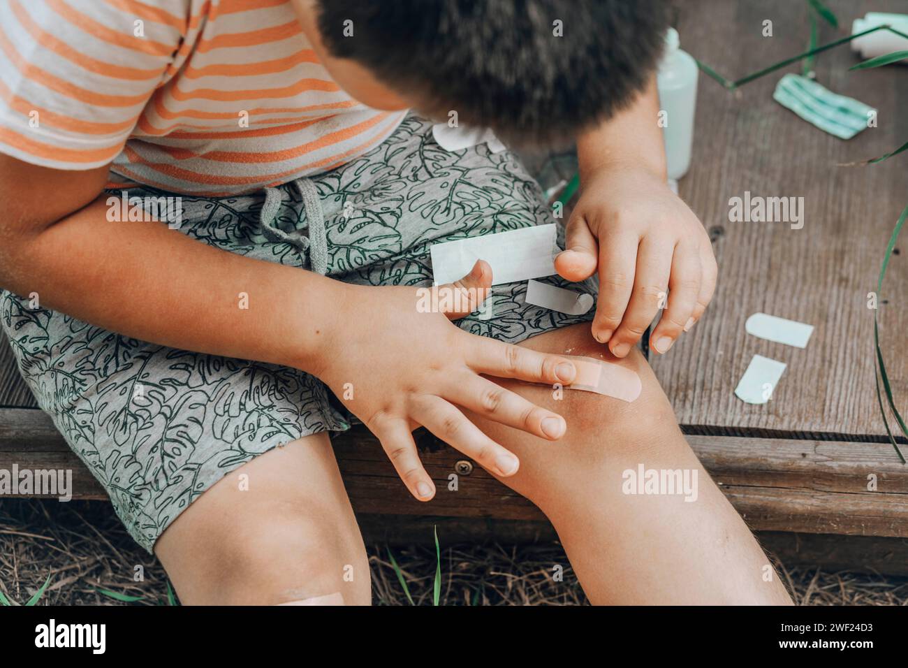 Close-up of a child's leg injury. The child injured his knee. A boy ...