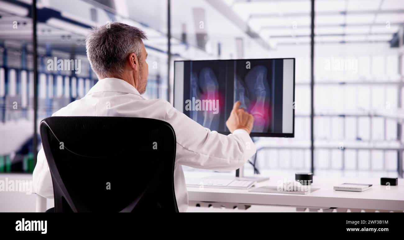 Surgeon holding xray knee hi-res stock photography and images - Alamy