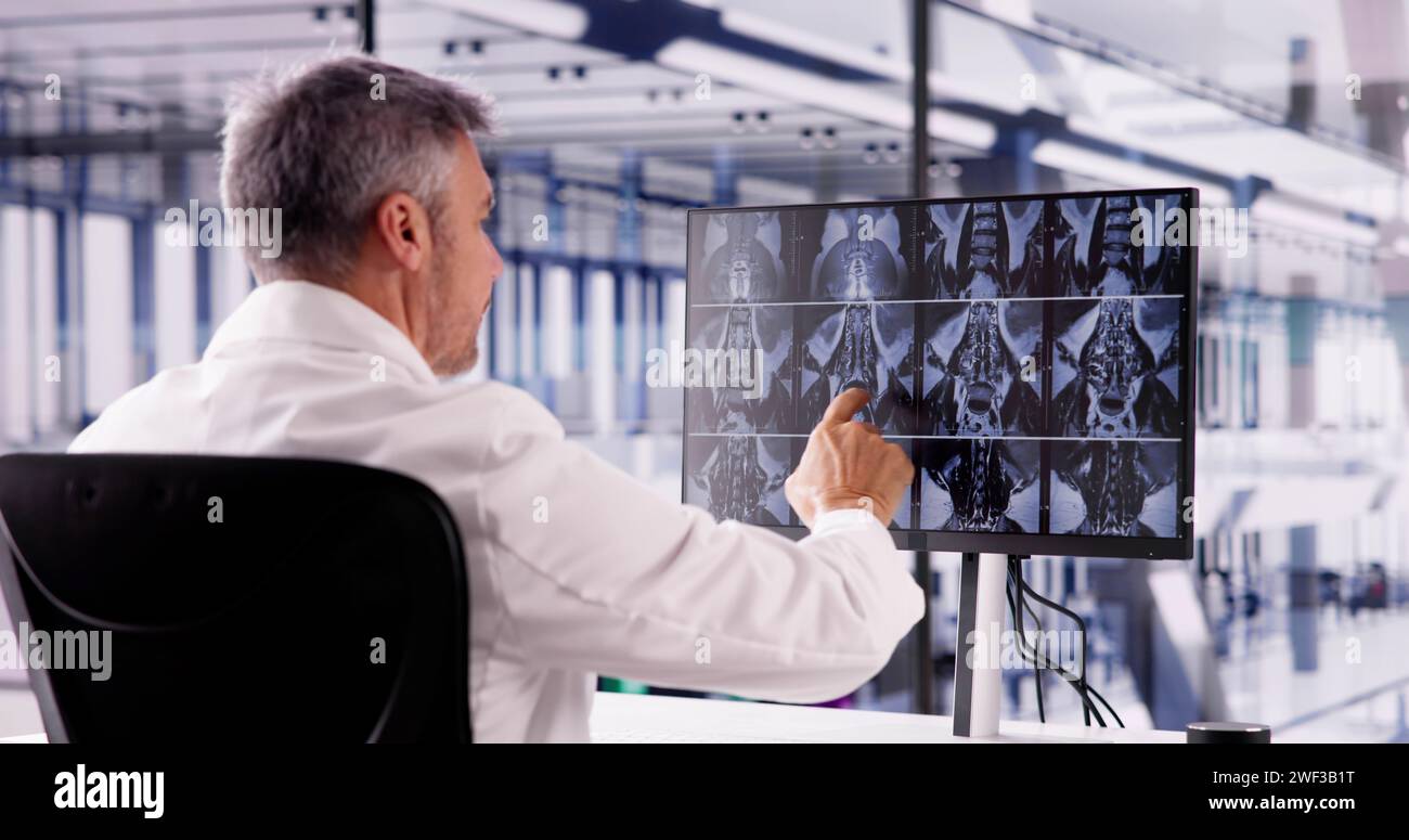 X ray screens hi-res stock photography and images - Alamy