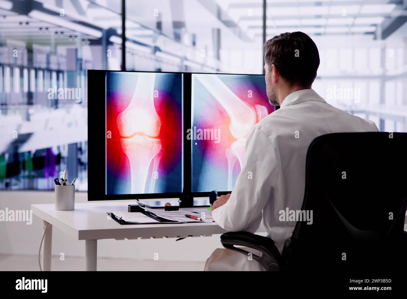Doctor Screening Knee Bone X Ray On Computer Stock Photo - Alamy