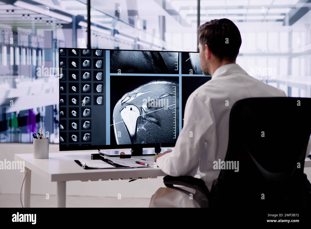 Doctor Screening Knee Bone X Ray On Computer Stock Photo - Alamy