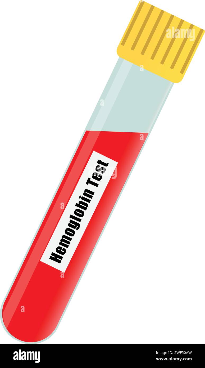 Hemoglobin Blood Test, Tube with blood, Medical Test blood sample, test ...