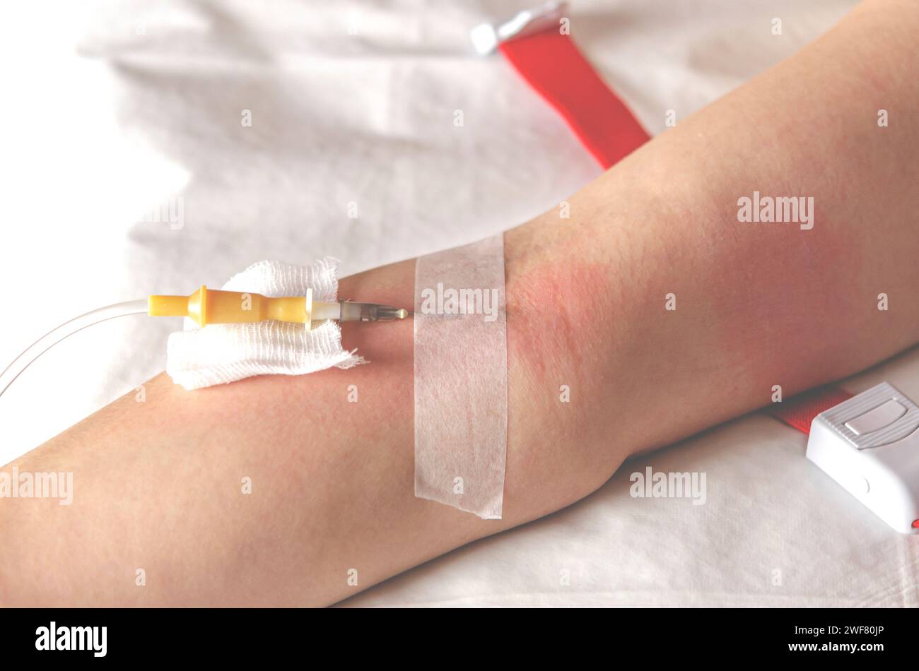 Medicine. Intravenous injection. The drip is intravenous. First aid ...
