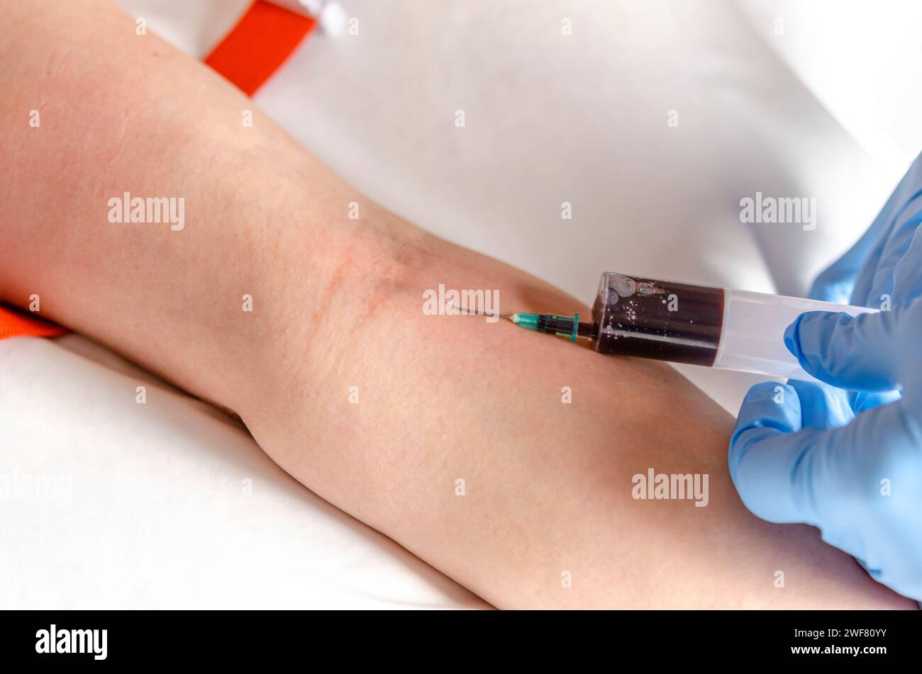 Nurse with syringe in hands. Blood test from a vein Stock Photo - Alamy