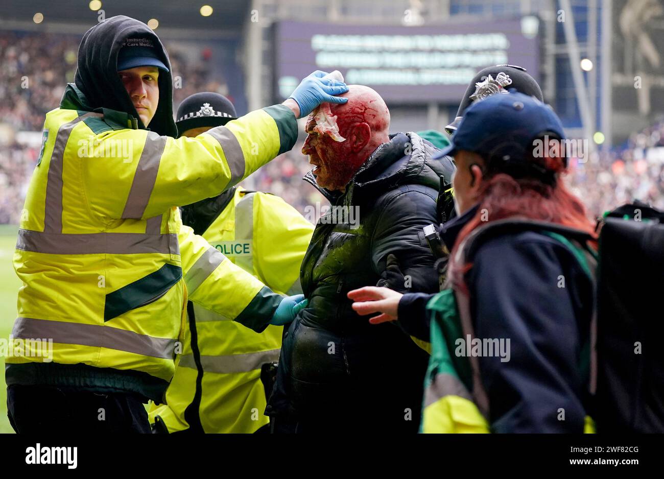 EDITORS NOTE - BLOOD Police officers remove a fan who received a cut to ...