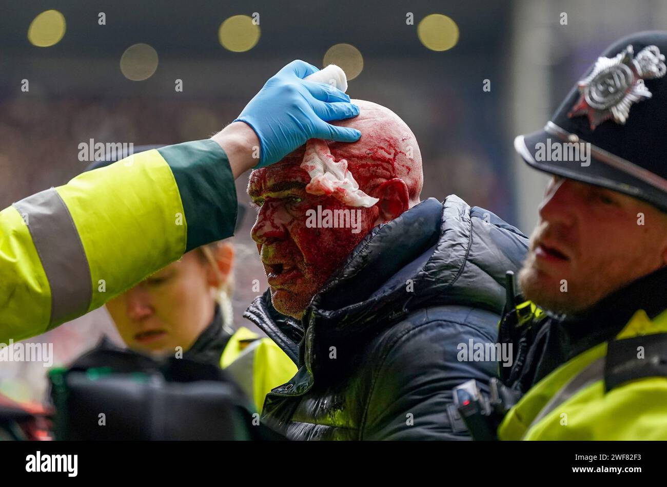 EDITORS NOTE - BLOOD Police officers remove a fan who received a cut to ...