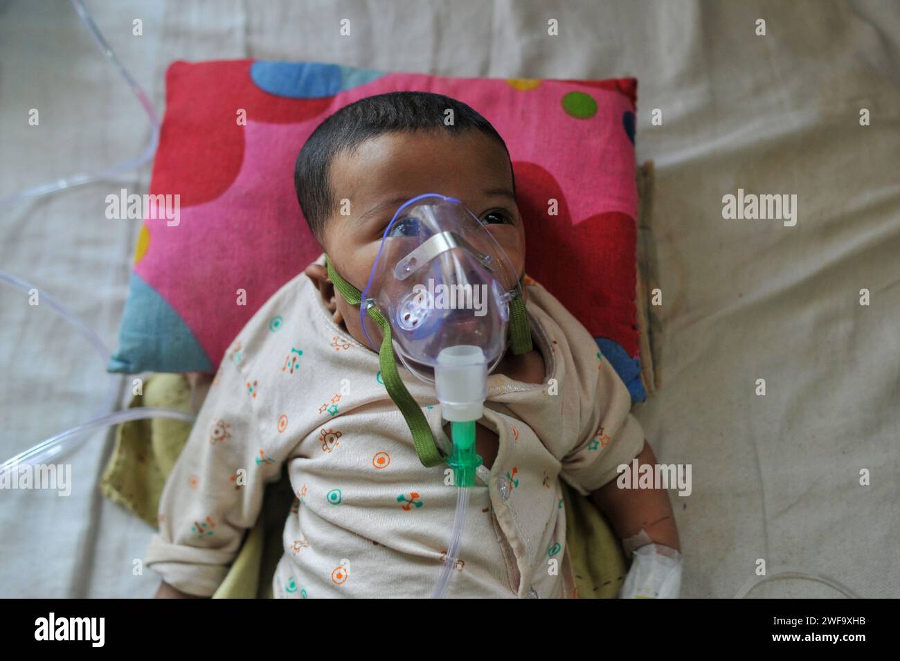 Sylhet, Bangladesh. 29th Jan, 2024. A child being treated for breathing ...