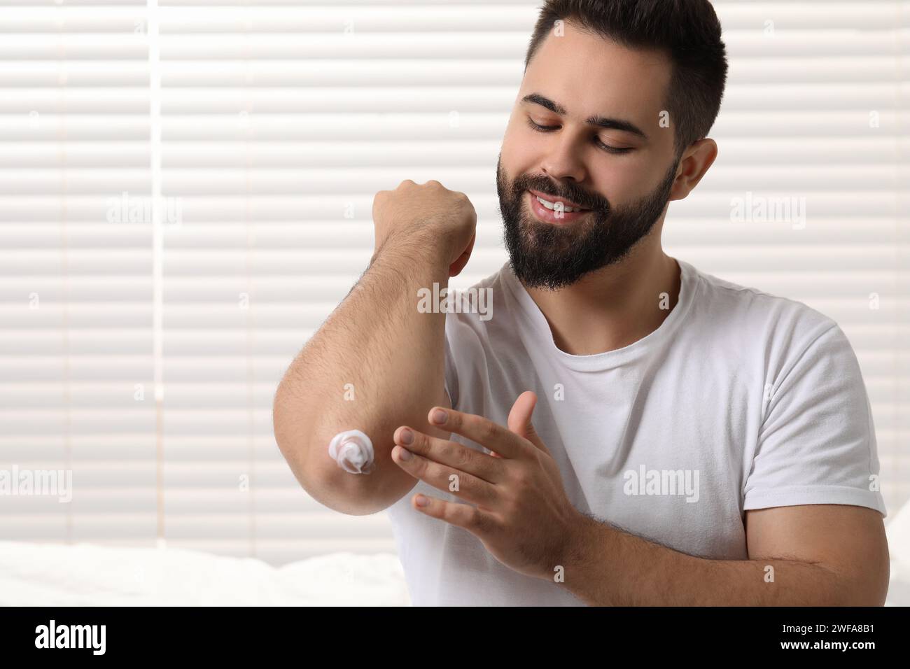 Man with dry skin applying cream onto his elbow indoors, space for text ...