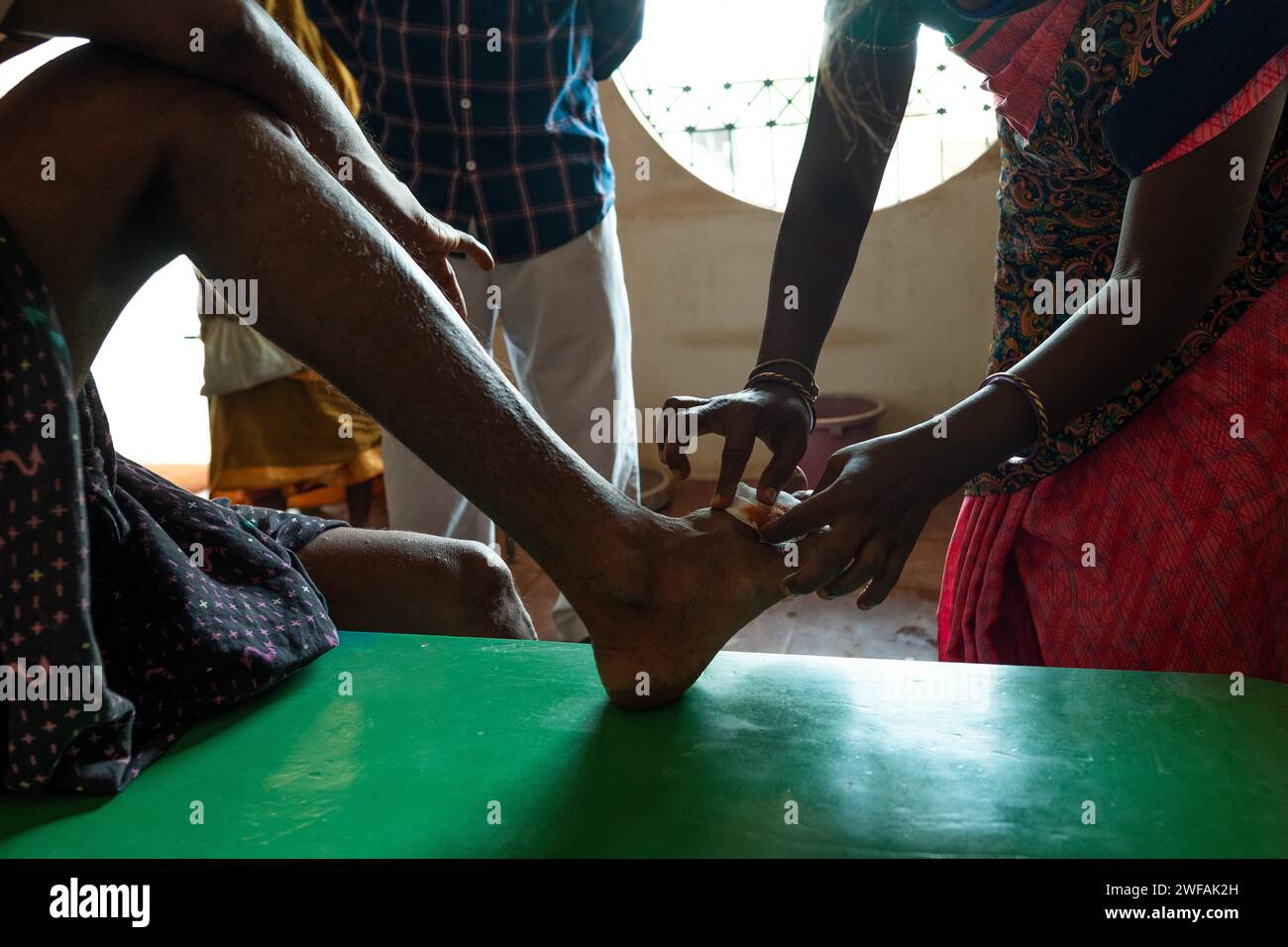 Nurse treating a man with a wound on his right foot, rural health ...