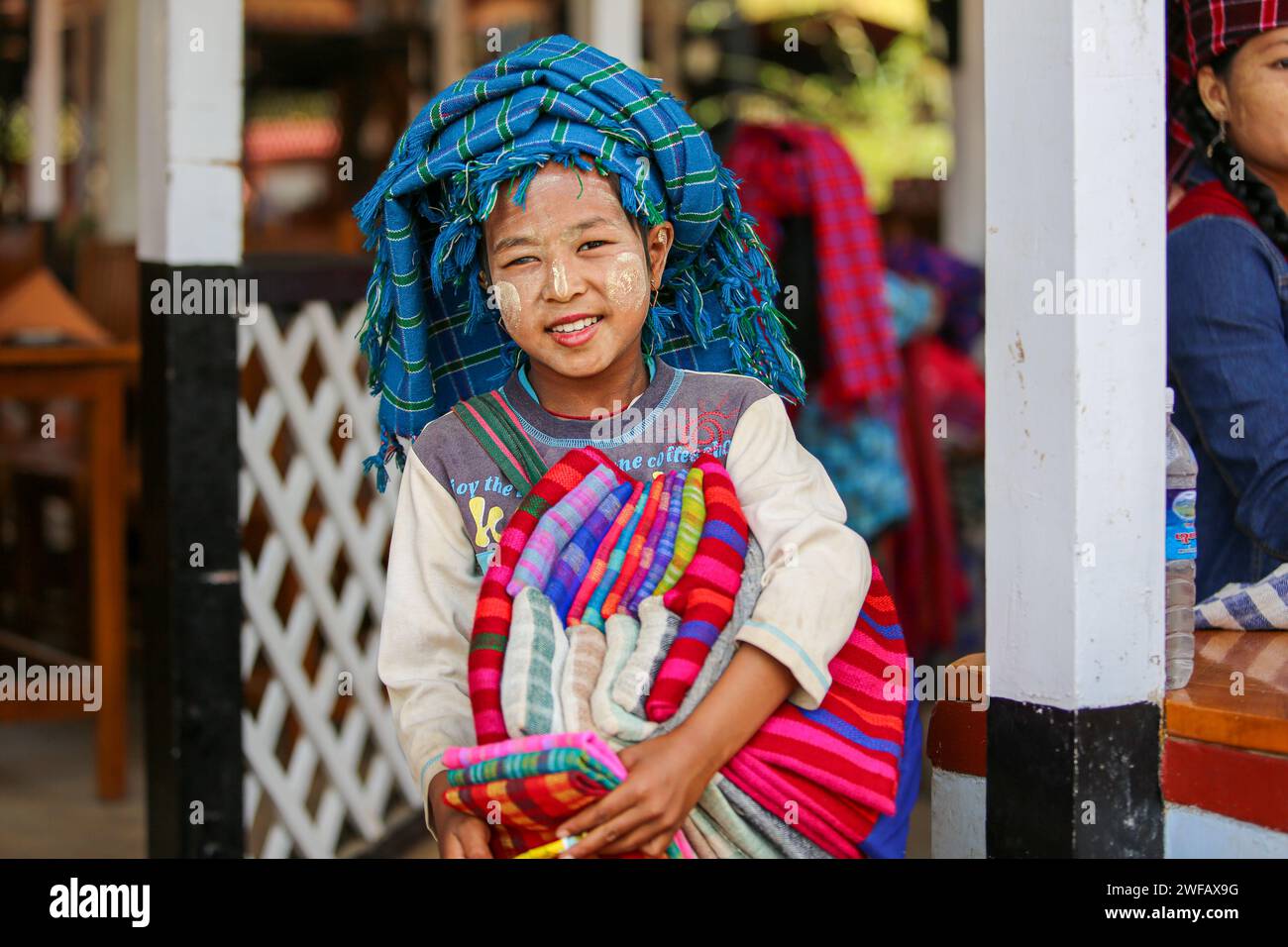 Young Burmese one-eyed girl with beautiful smile and thanaka paste on the cheeks, Inle Lake ...