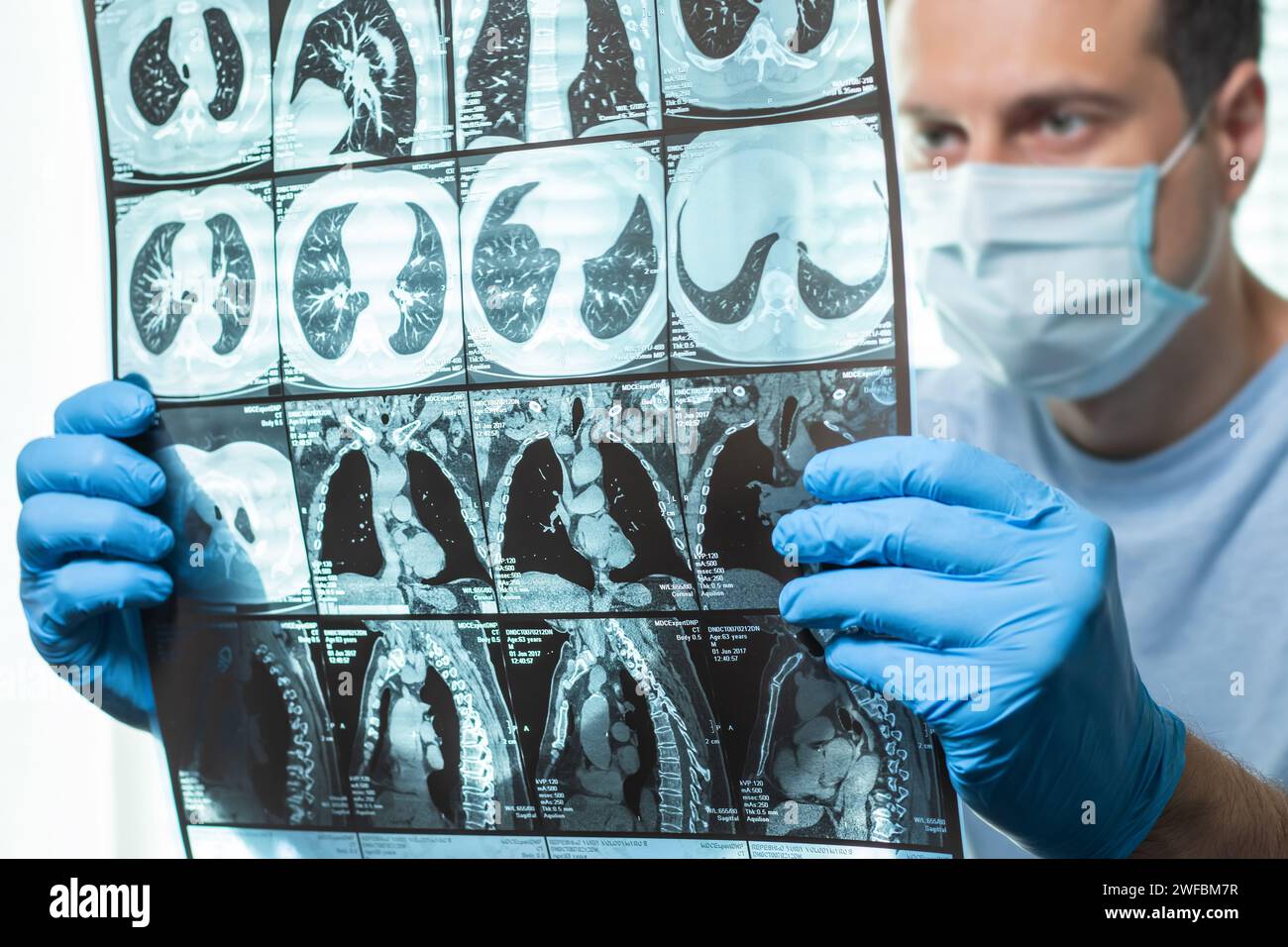 Mri scan man head hi-res stock photography and images - Alamy