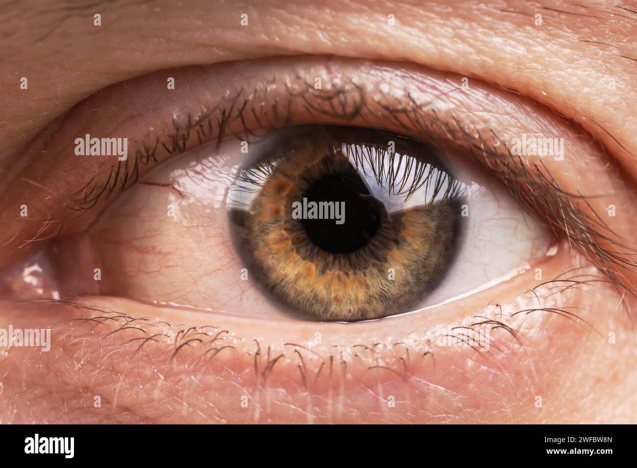 Macro image of human eye with red capillaries Stock Photo - Alamy