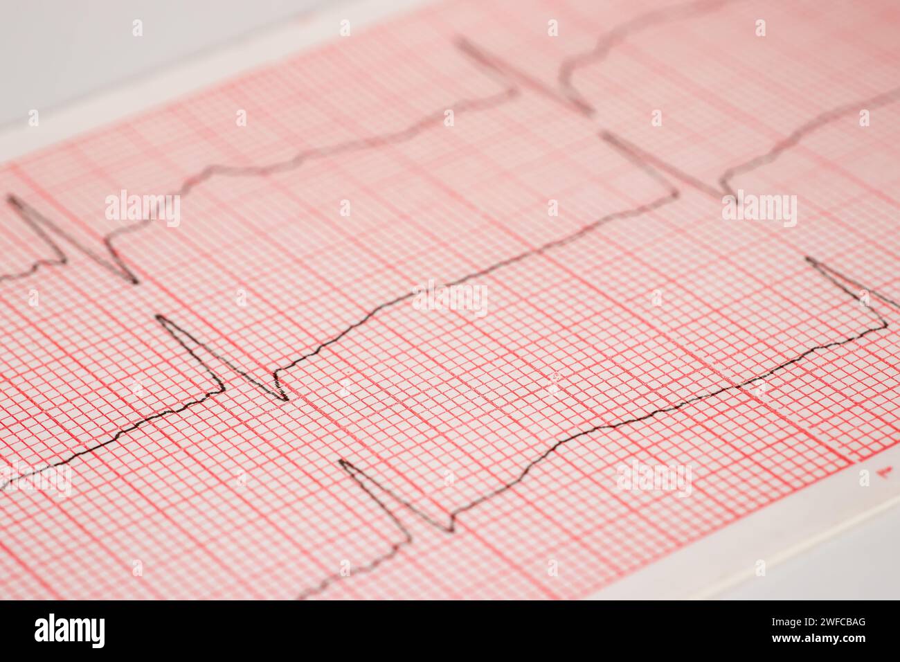heart rhythm ekg note on paper Doctors use it to analyze heart disease ... heart rhythm ekg note on paper Doctors use it to analyze heart disease ...